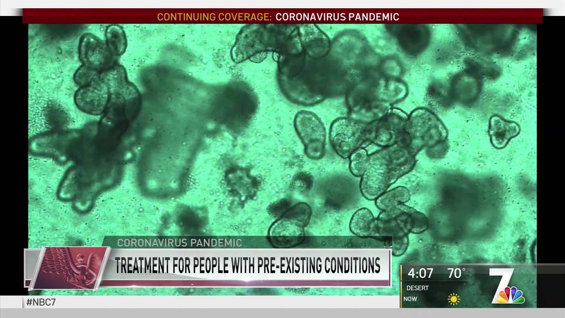 San Diego Scientists Use ‘Mini Lungs’ to Find Treatments for COVID-19 ...