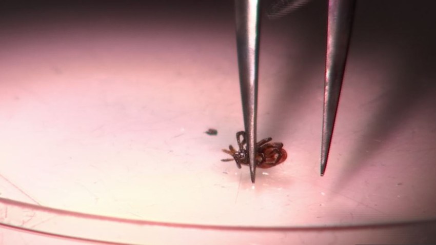 Ticks Test Positive for ‘Rabbit Fever’ in Sorrento Valley – NBC 7 San Diego