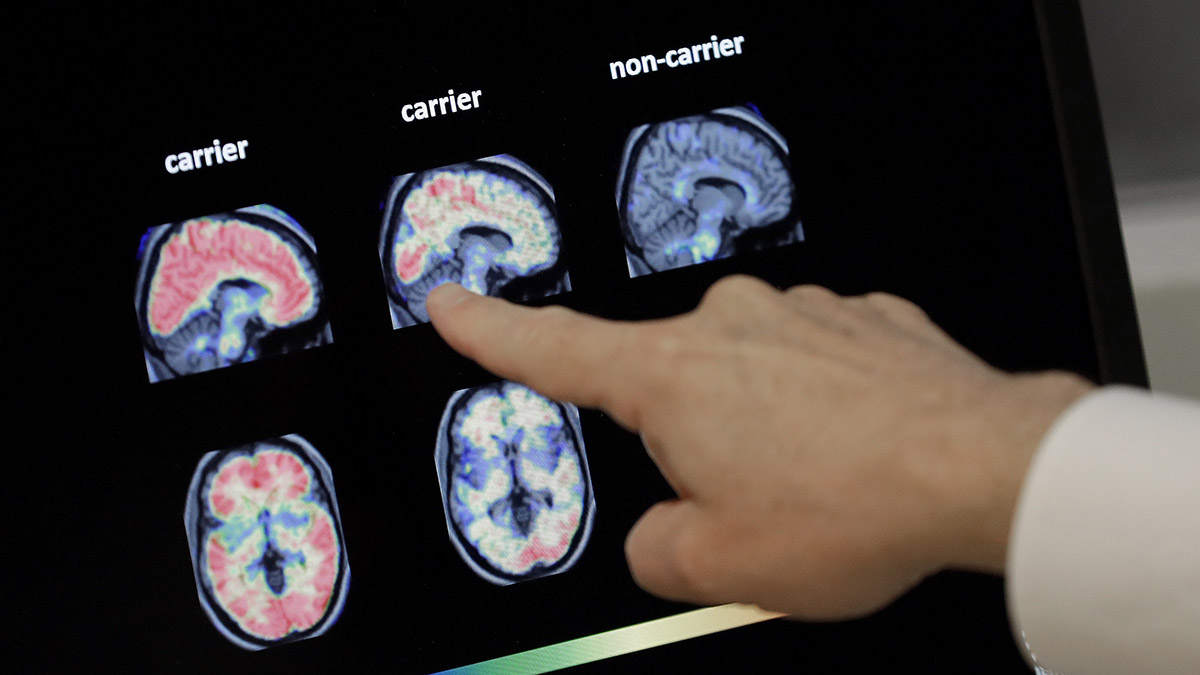San Diego will be 1 of the first cities to use new treatment for ...