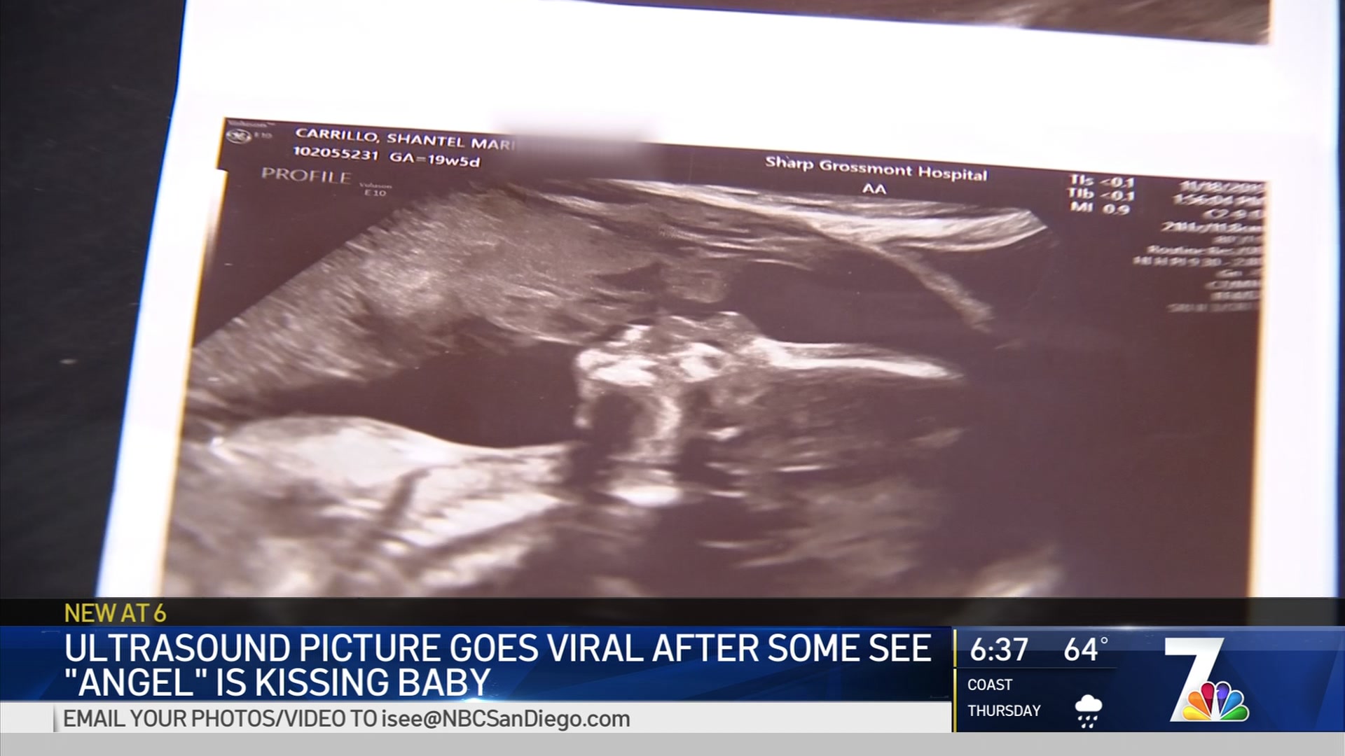 Ultrasound Picture Goes Viral Over Angel Seen Kissing Baby – NBC 7 San ...