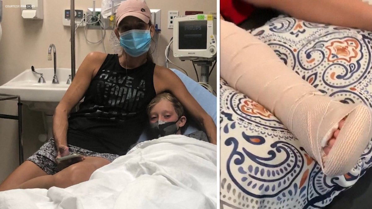 Boy Bit by Shark: It Bit Me and ‘Just Took Off’ – NBC 7 San Diego