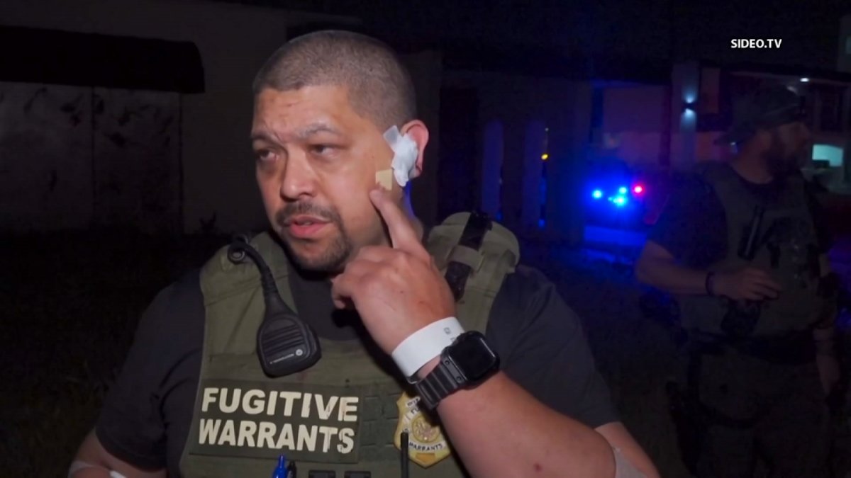Bounty Hunter Shot in the Face in El Cajon Survives, Recalls Incident ...