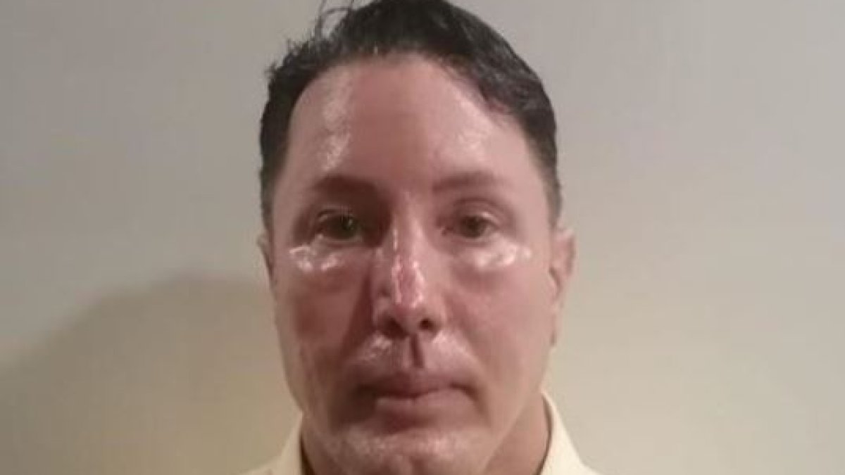 Master of Disguise: Fugitive Altered Face With Plastic Surgery Before ...