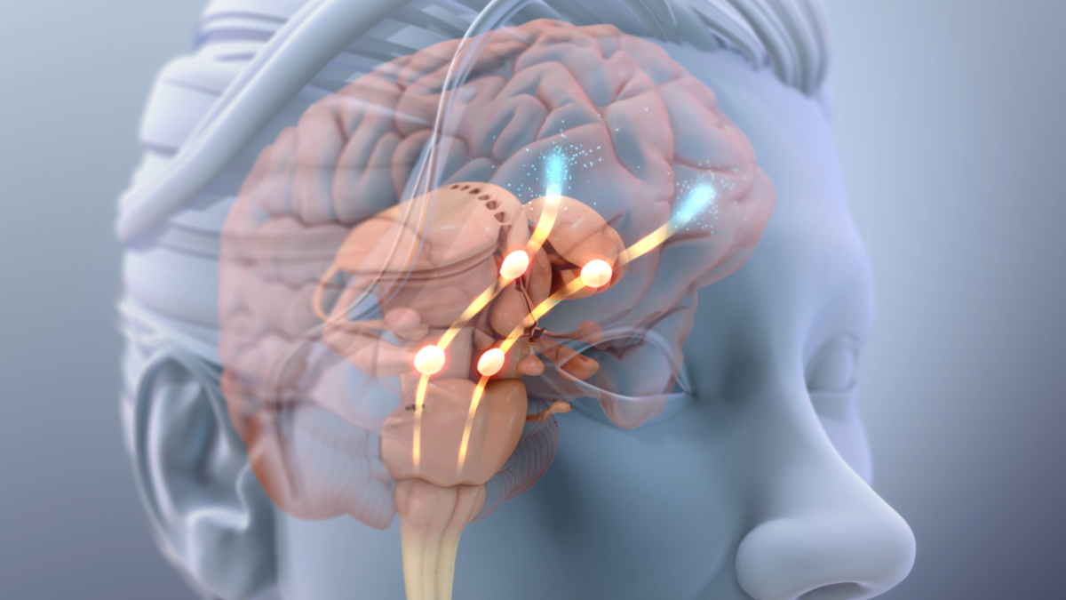 How the Addicted Brain Works – NBC 7 San Diego