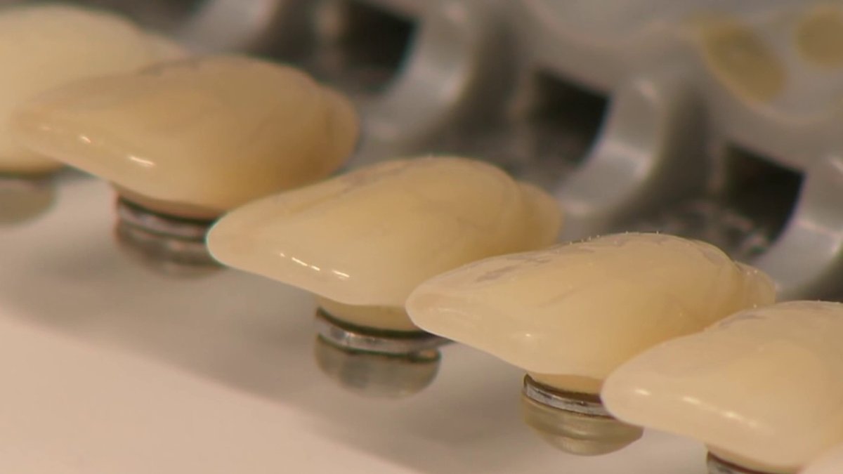 Beware of DIY Dental Hacks That Could Destroy Your Smile – NBC 7 San Diego