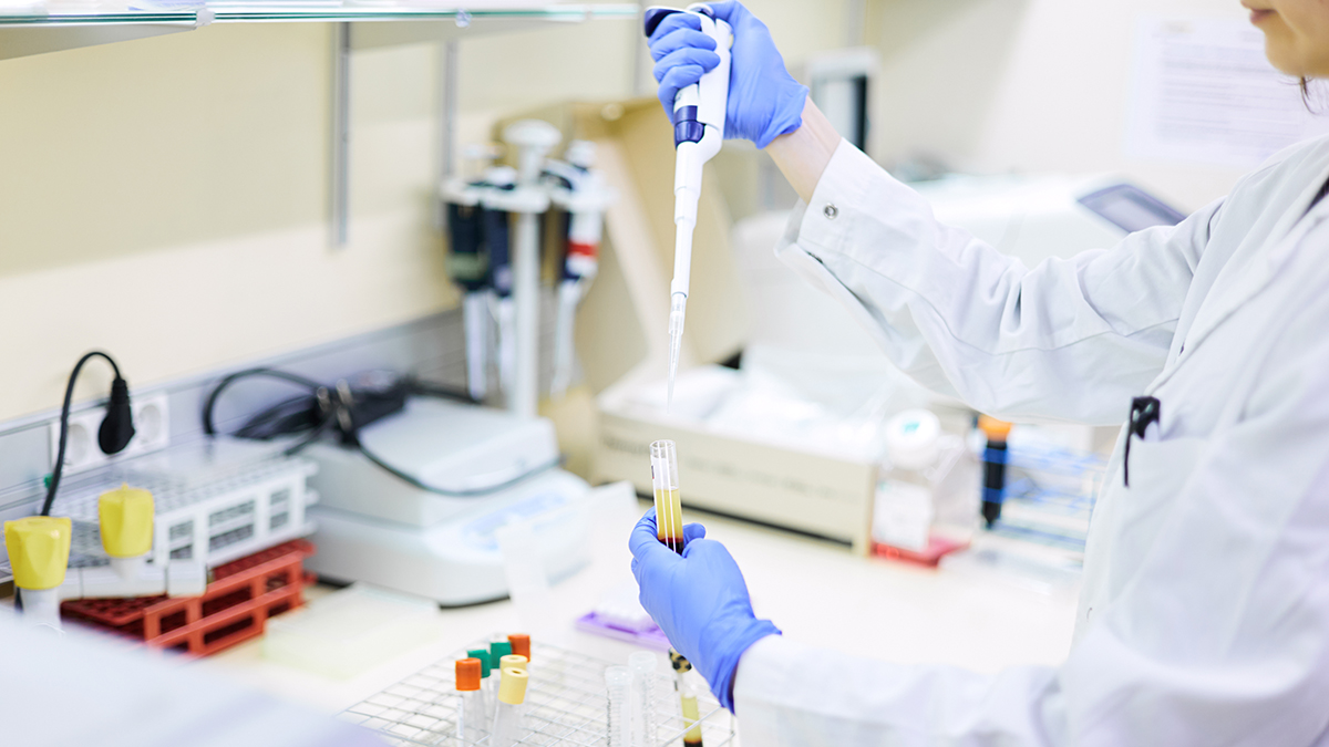 A blood test for long Covid is possible, a study suggests – NBC 7 San Diego