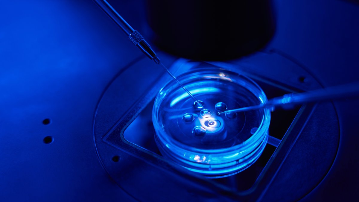 Meet the women who pioneered the development of IVF – NBC 7 San Diego