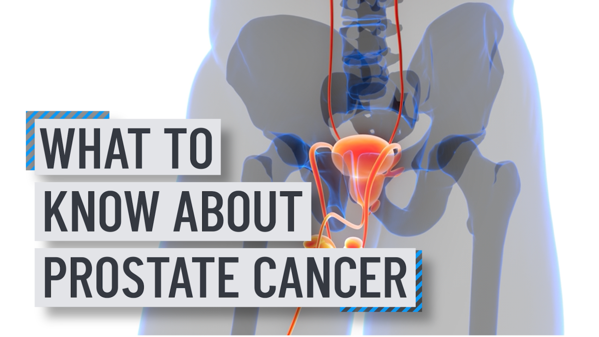 What you need to know about prostate cancer – NBC 7 San Diego