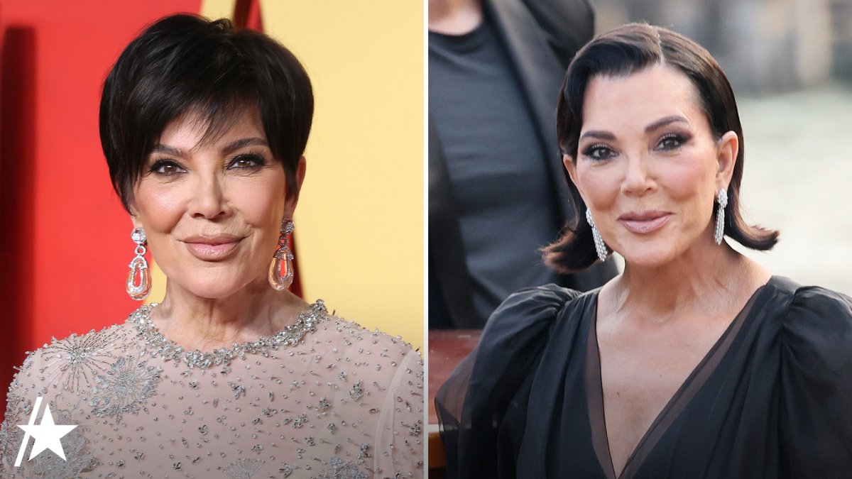 Kris Jenner discusses viral facelift at 69 in new magazine interview ...